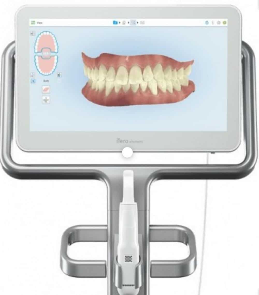 Intraoral Scanners Are The Wave Of The Future: Kaivan Kiai, DDS ...
